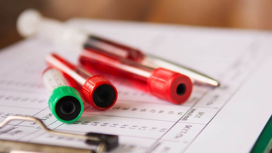 Aminogramm: Teste Deine Aminosäuren - so geht's! - Happy-Blood