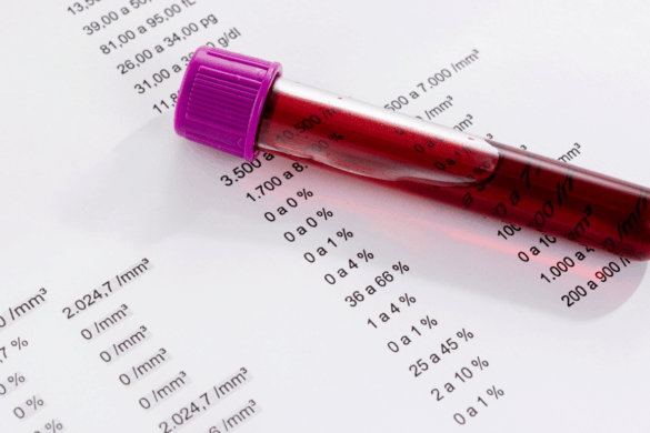 Bluttest Archive - Happy-Blood